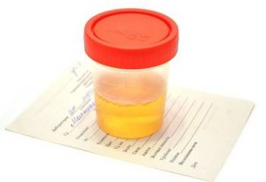 Smelly Urine in Male & Female - Main Causes of the Issue