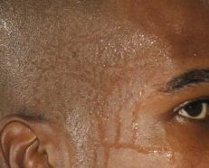 Excessive Head Sweating While Sleeping at Night | IYTmed.com