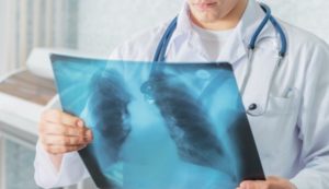 Heavy Breathing: Causes and Treatments | IYTmed.com