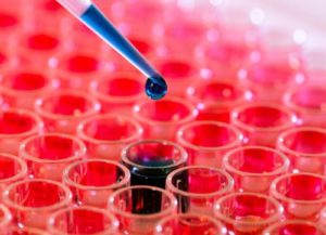 Low Lymphocyte Count: Causes, Symptoms and Treatment | IYTmed.com