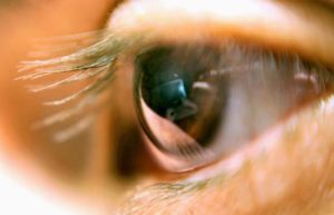Symptoms of What Are Dizziness and Blurred Vision? - IYTmed.com