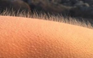 Chills and Fever: Causes and Treatment | IYTmed.com