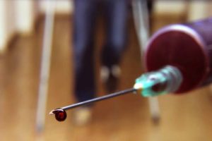 CEA Blood Test - What You Should Know