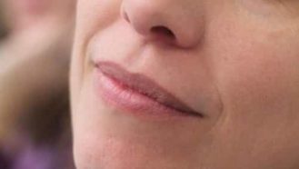 Lips Discoloration: Causes and Treatment | IYTmed.com