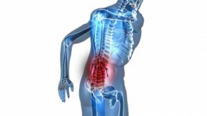 Gas Pain in Back: Causes and Treatments | IYTmed.com
