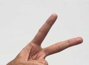 How to Check Yourself for Dilation? - IYTmed.com