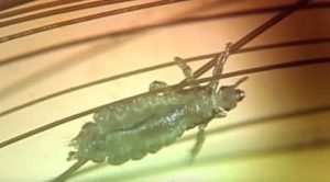 How to Check Yourself for Lice - IYTmed.com