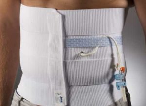 Abdominal Binder Usage and Precautions