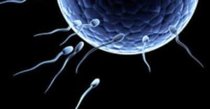 What Does Yellow Sperm Mean? - IYTmed.com