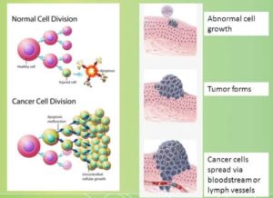 How Are Cancer Cells Differ From Normal Cells? - IYTmed.com