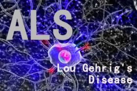 Life Expectancy for Lou Gehrig's Disease (ALS) | IYTmed.com
