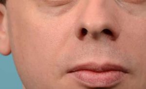 What Causes of Nose Twitching? - IYTmed.com