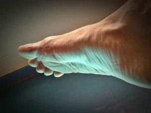 Double Nails on Toes: Causes and Remedies - IYTmed.com