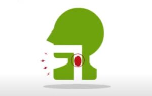 Tightness in Throat: Causes, Treatment and More - IYTmed.com